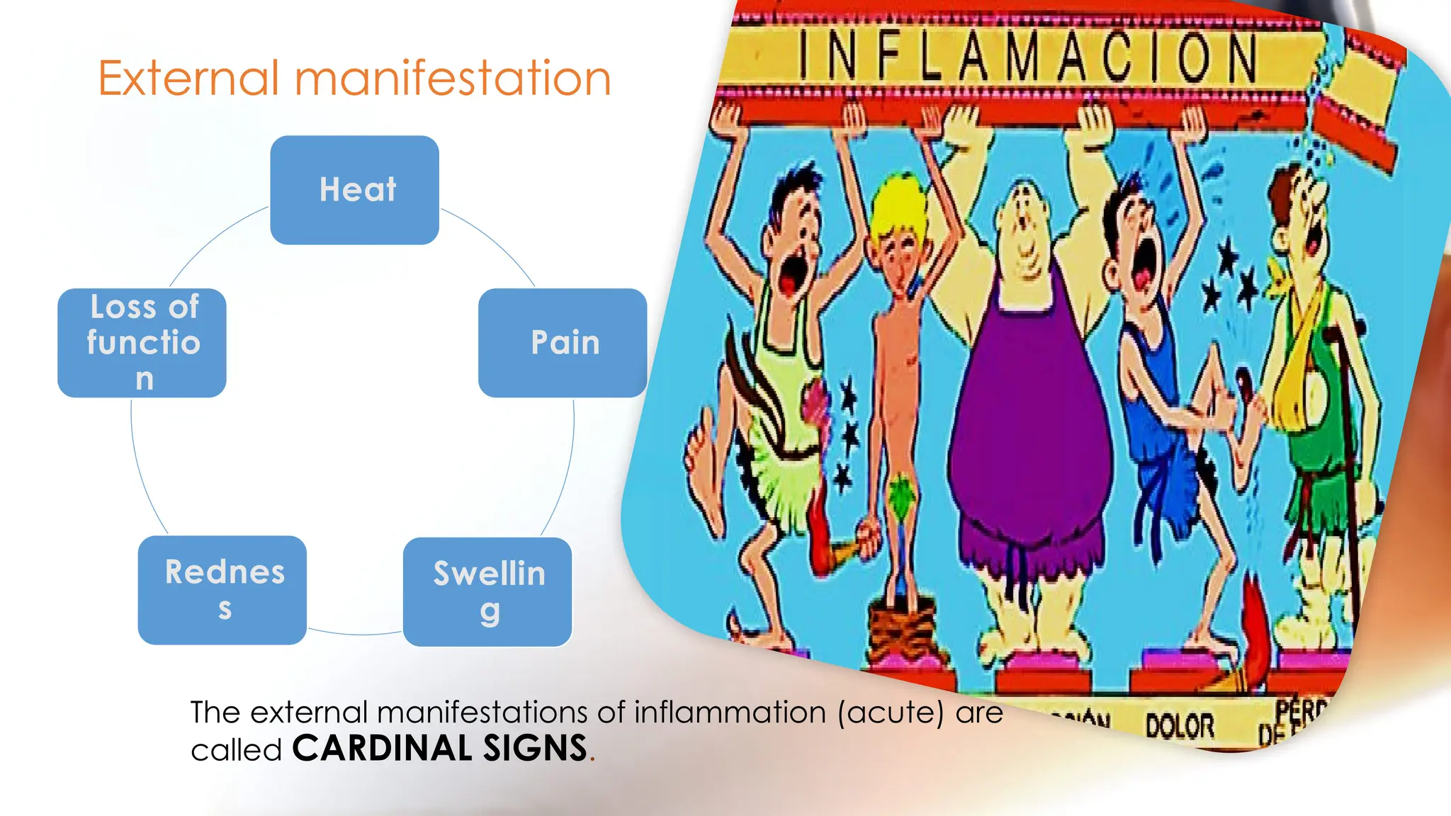Acute inflammatiom, inflammation, acute pptx | PPTX