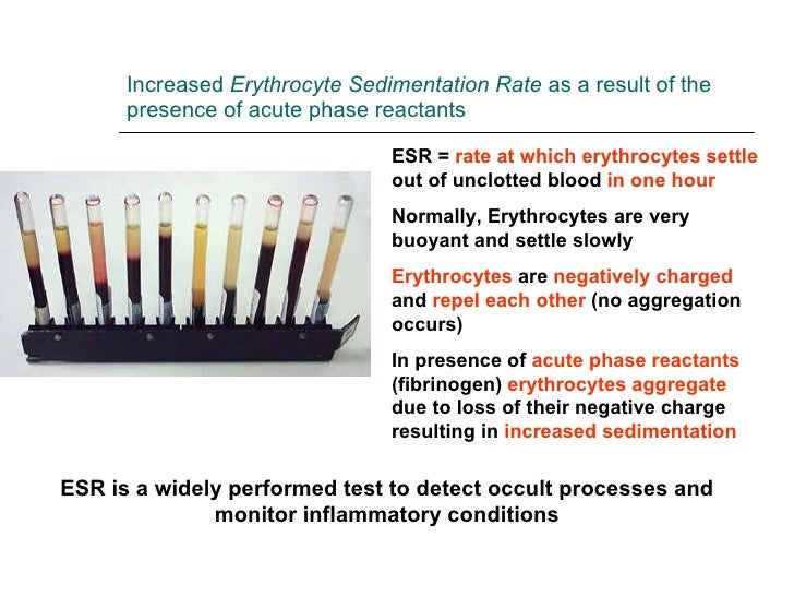 Acute inflammation