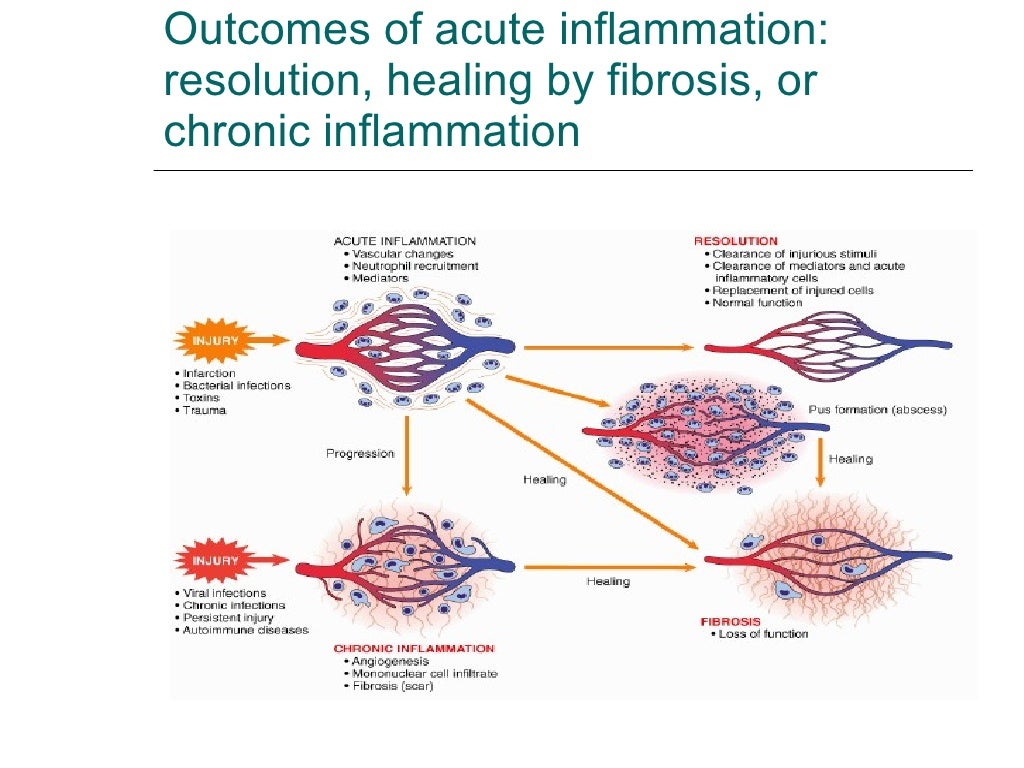 Acute inflammation