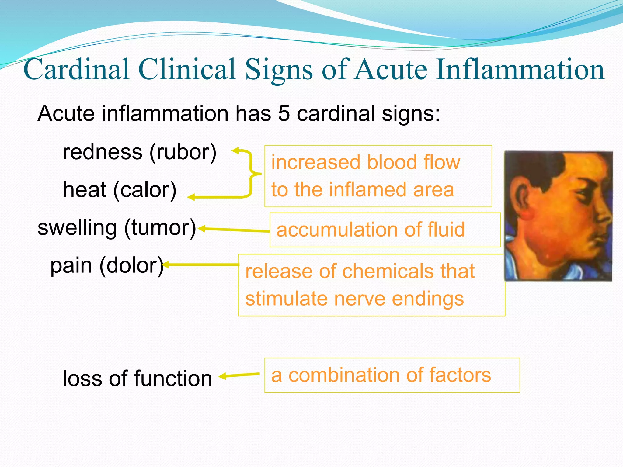 Acute inflammation | PPTX | Blood Disorders | Diseases and Conditions