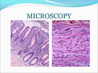 Acute inflammation | PPT
