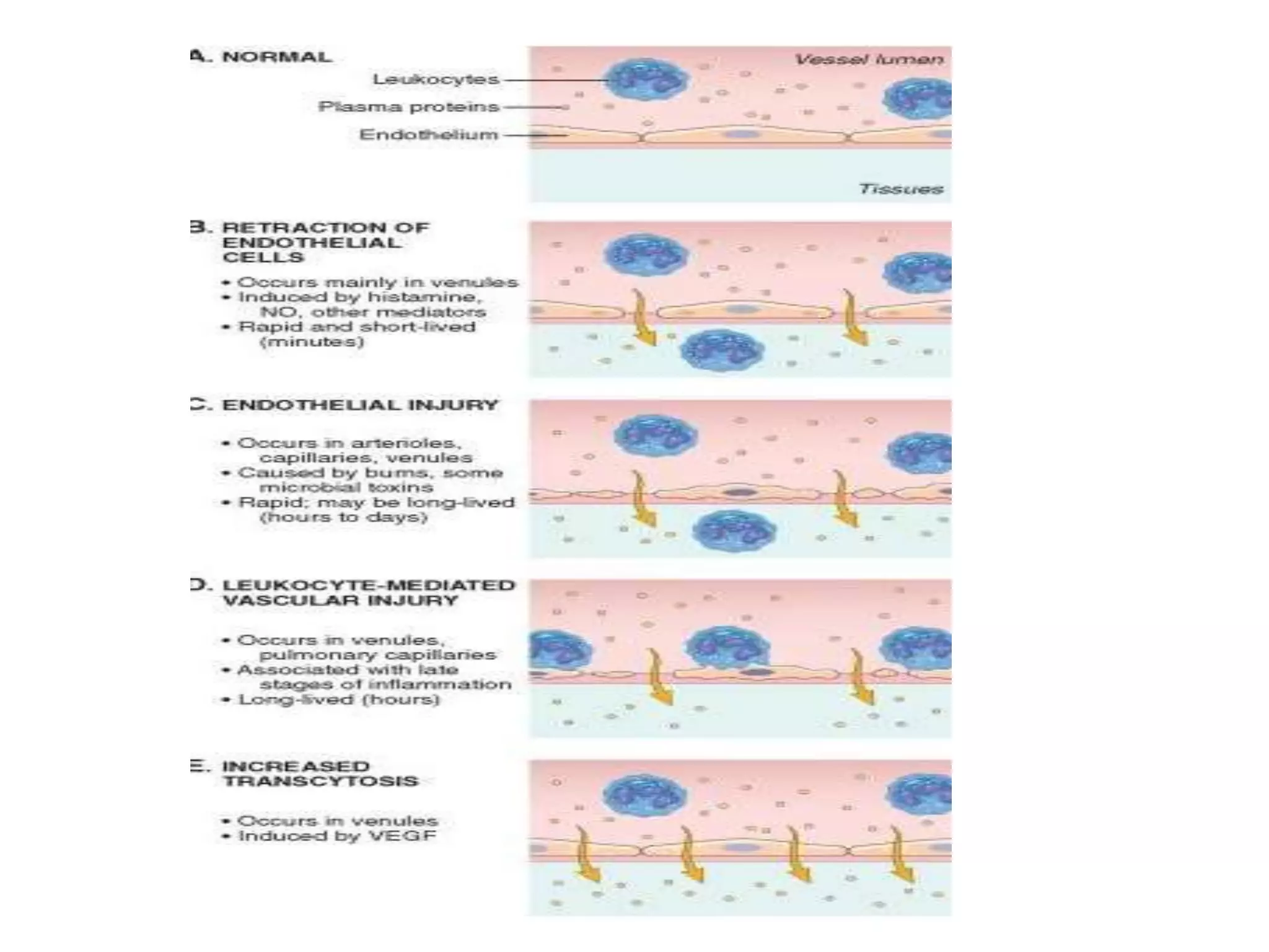 Acute inflammation | PPTX | Blood Disorders | Diseases and Conditions