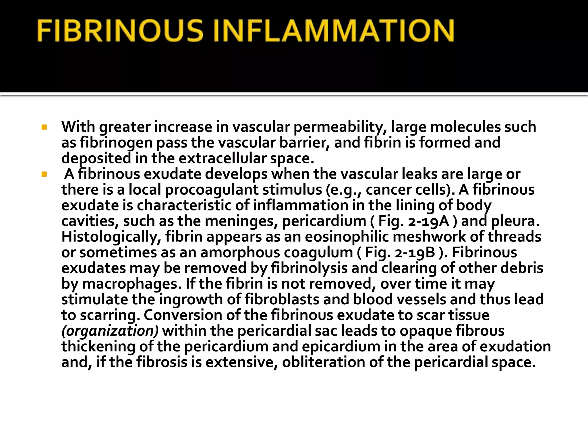 Acute inflammation | PPTX | Blood Disorders | Diseases and Conditions