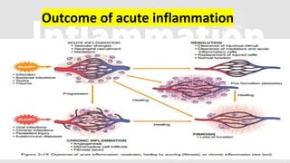 Acute Inflammation- for pharmacy students | PDF