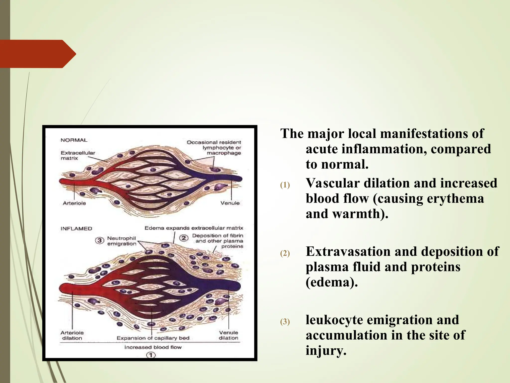 Acute Inflammation (2).ppt pathology subject | PPT