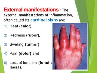 ACUTE INFLAMMATION Slides Pathology. pdf | PDF