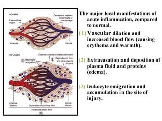 Acute inflammation optimetery lect 2 | PPT