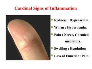 Acute inflammation optimetery lect 2 | PPT