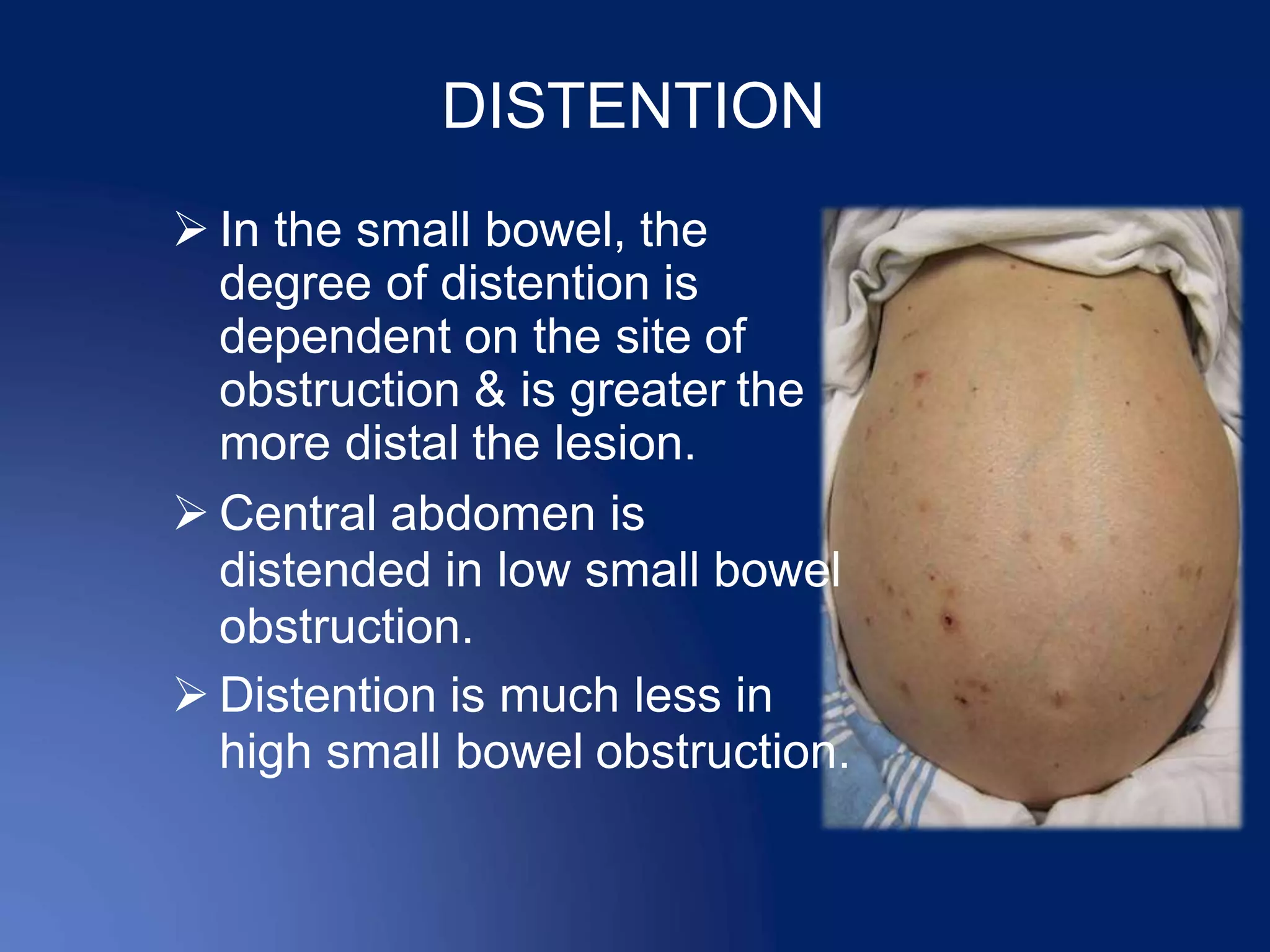 Acute intestinal obstruction | PPTX