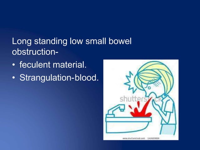 Acute intestinal obstruction | PPTX | Digestive Disorders | Diseases ...