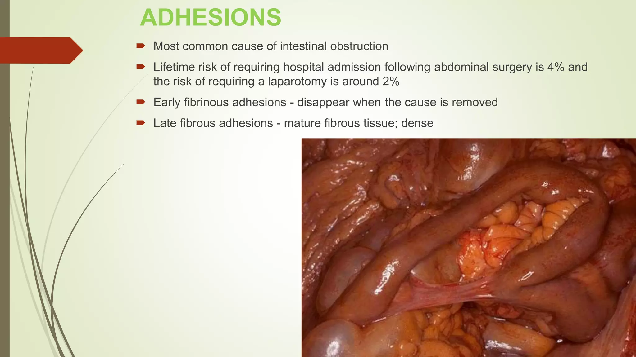 Intestinal Obstruction.pptx