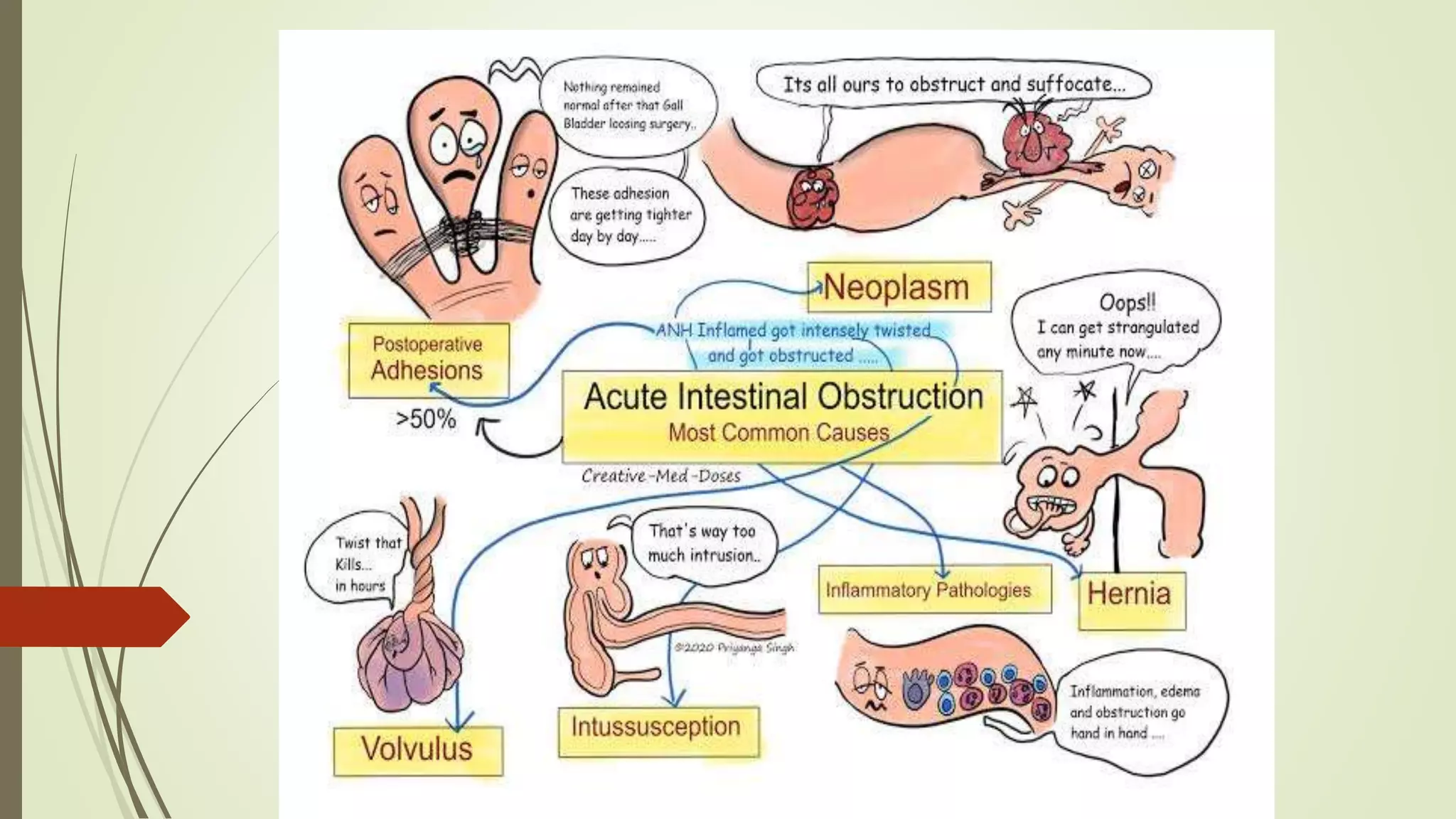 Intestinal Obstruction.pptx