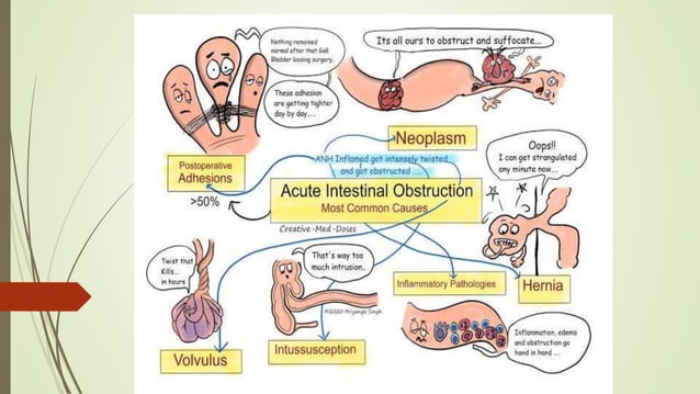 Intestinal Obstruction.pptx