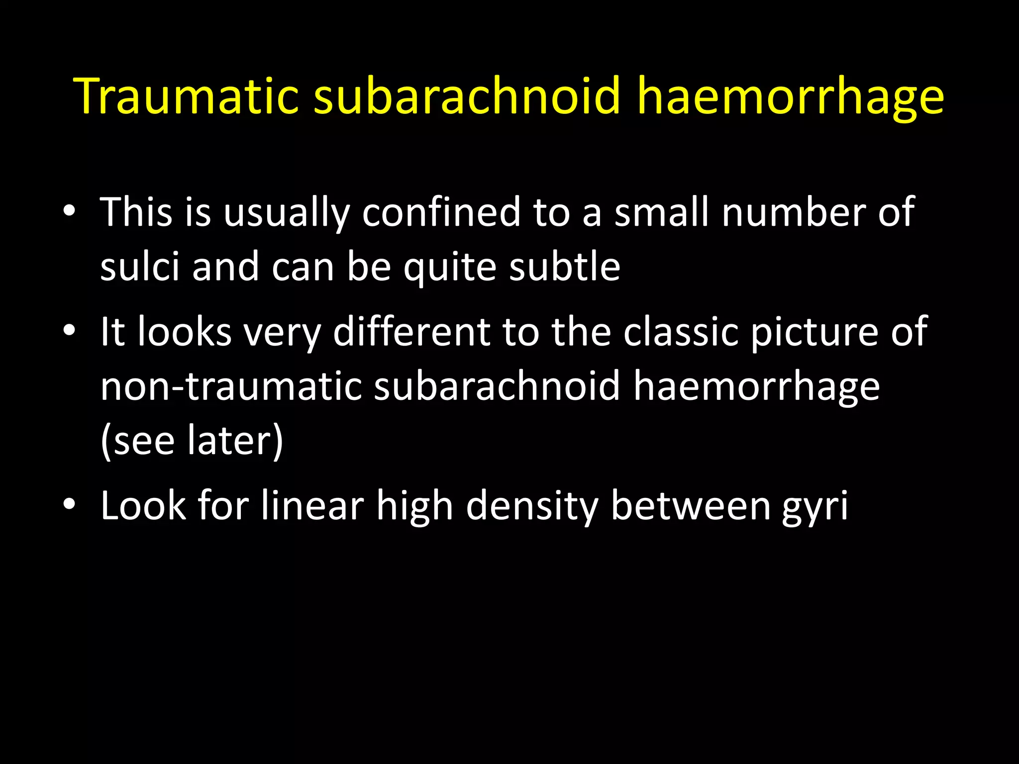 CT of acute intracranial pathology | PPTX