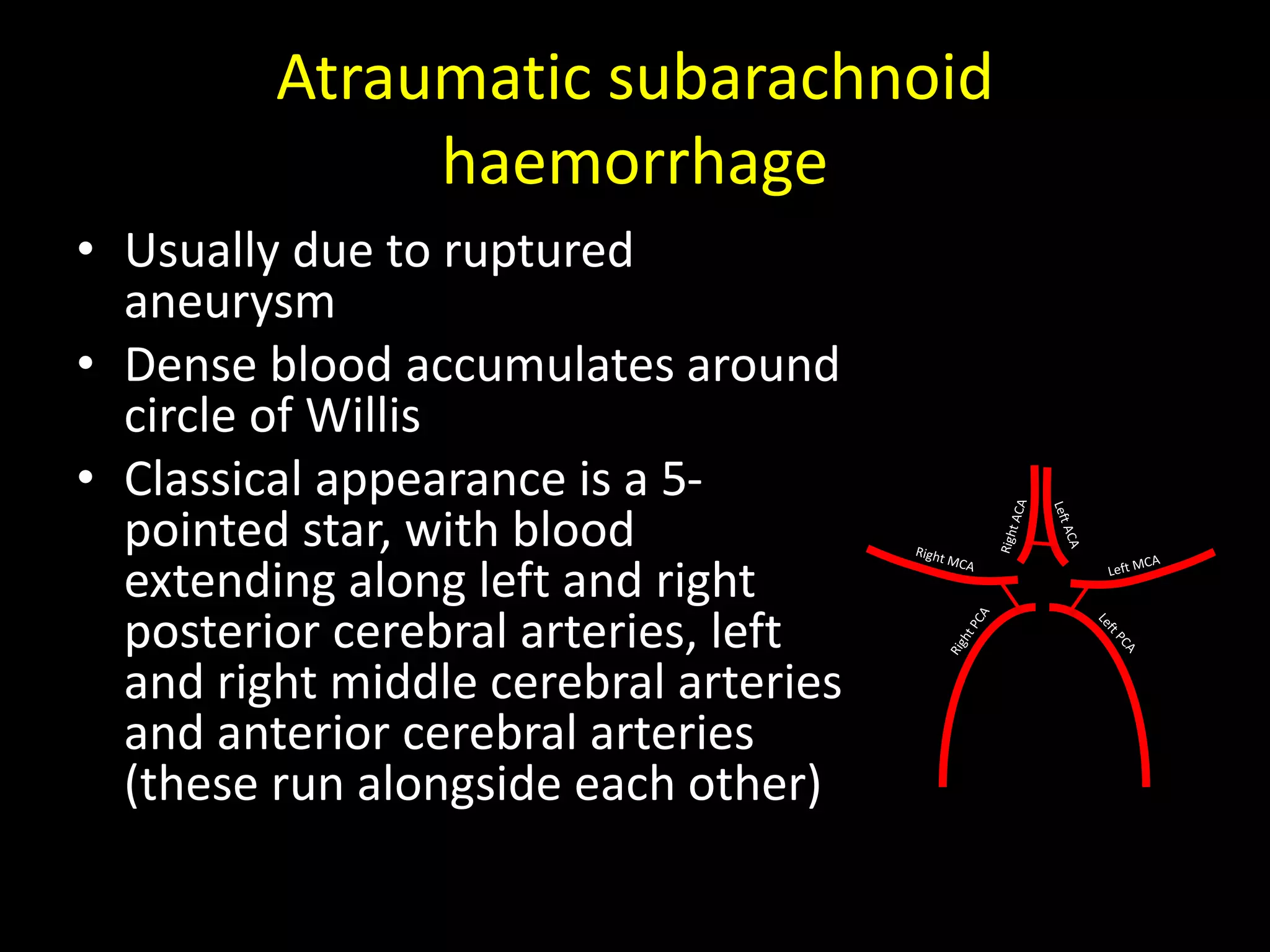 CT of acute intracranial pathology | PPTX