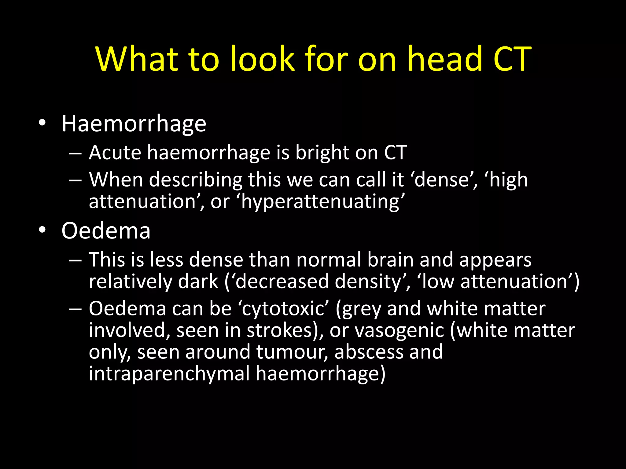 CT of acute intracranial pathology | PPTX