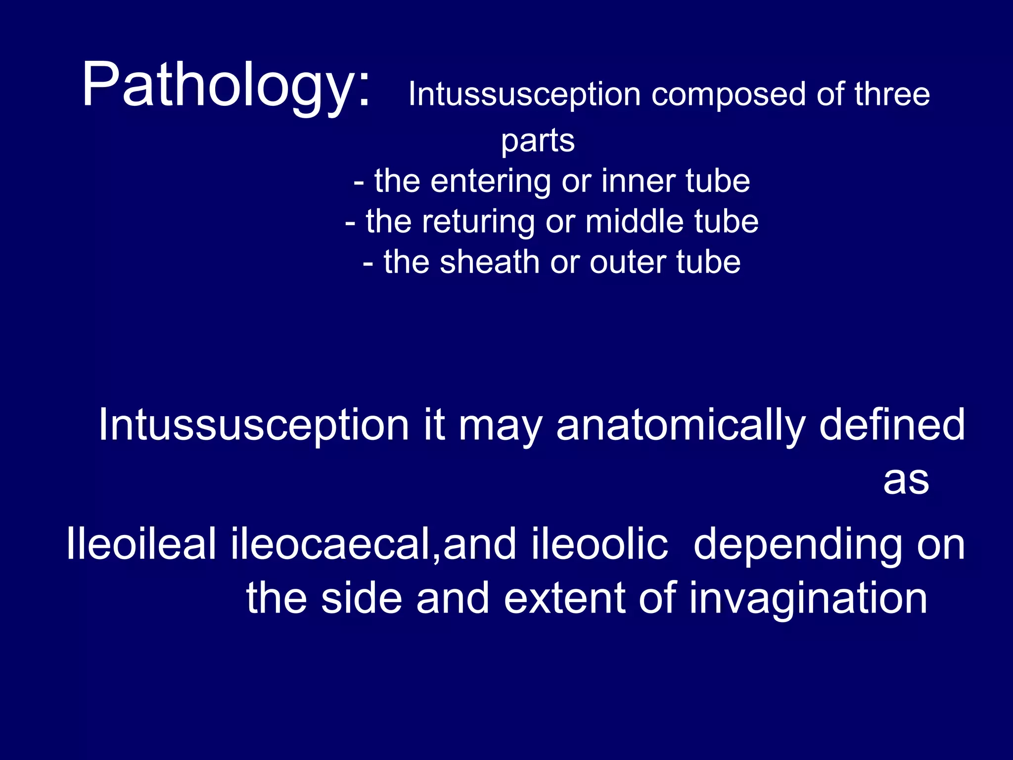 Acute intussusception | PPT