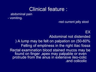 Acute intussusception | PPT