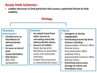 Acute ischemic limb | PPT