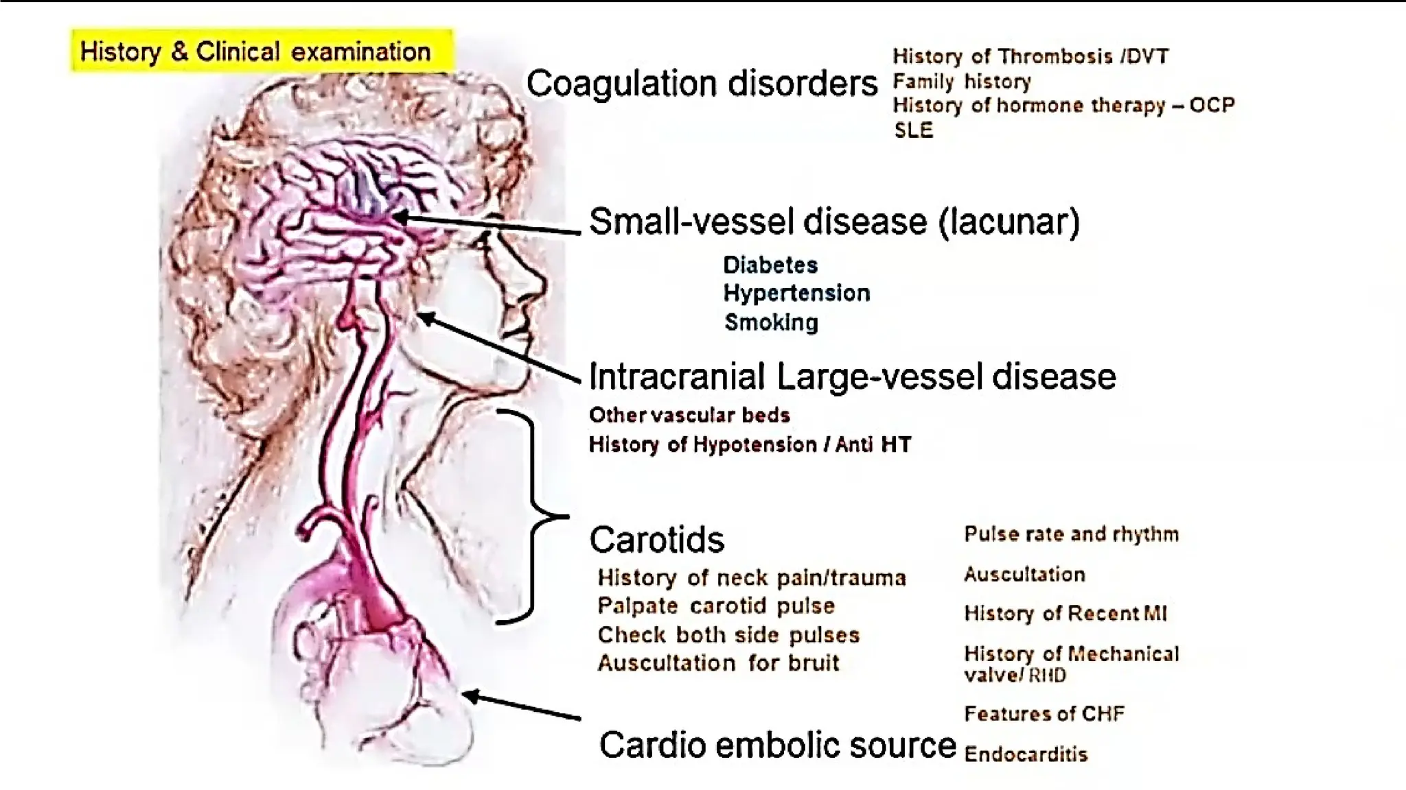 Acute cerebro vascular Ischemic stroke.pptx