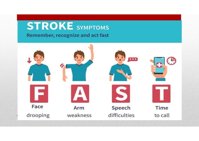 Acute ischemic stroke on alteplase therapy (thrombolysis) nursing ...