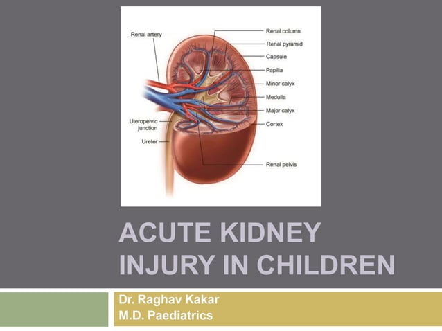 Acute Kidney Failure in children.pptx