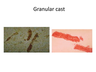 Acute kidney injury | PPT