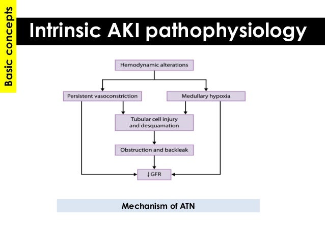 Acute kidney injury