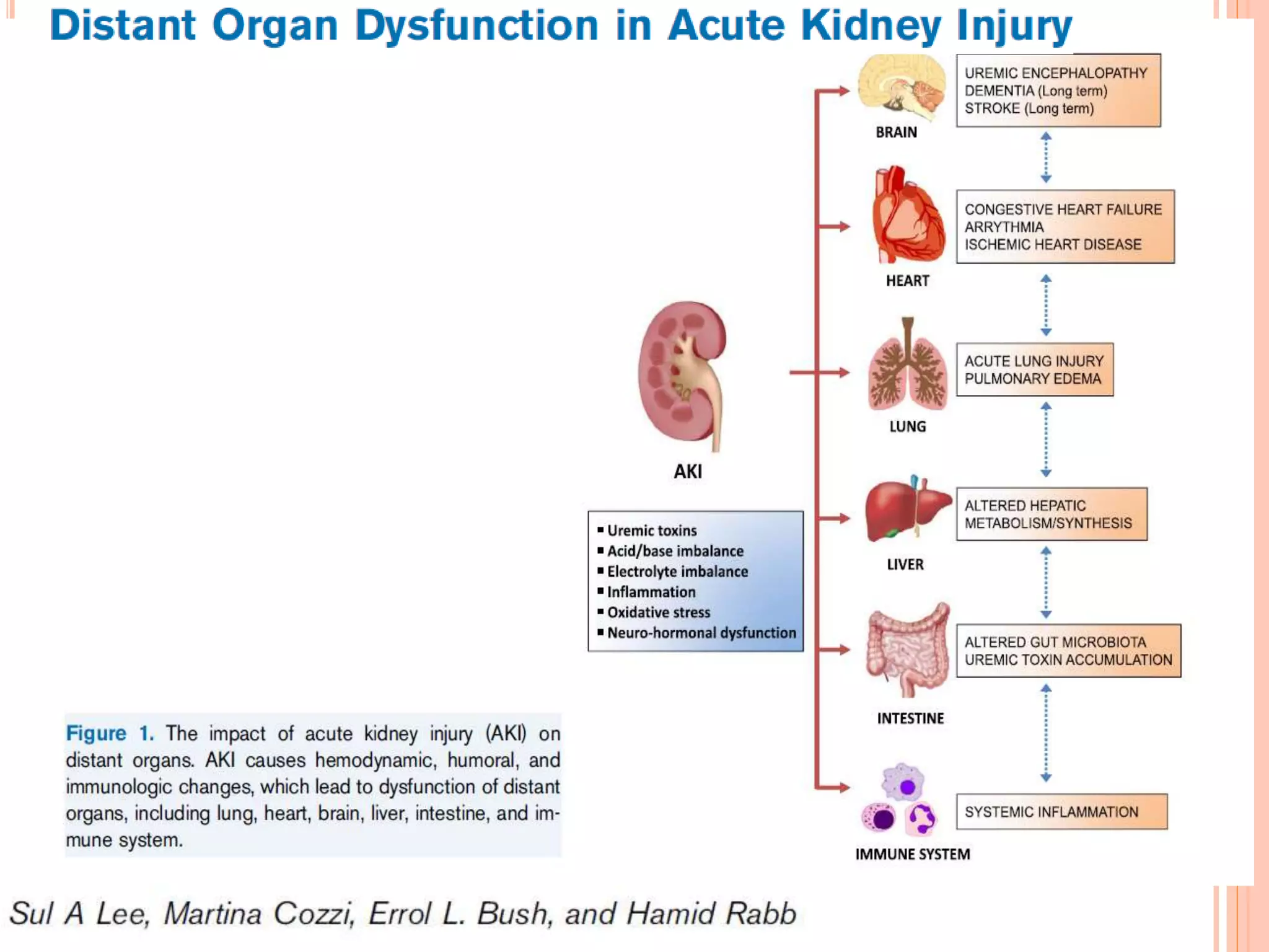 Acute kidney injury | PPT