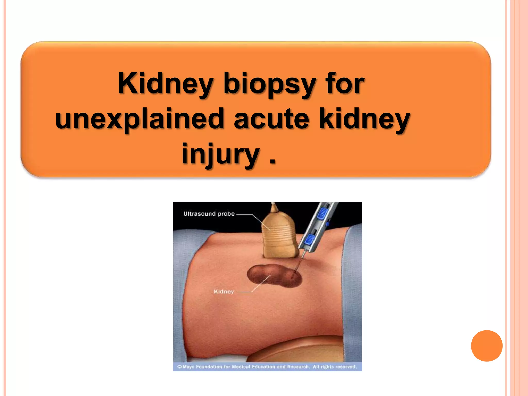 Acute kidney injury | PPT