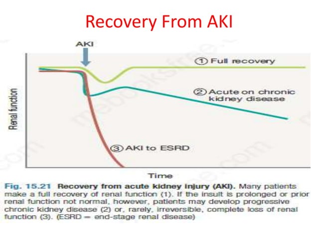 Acute kidney injury (AKI) | PPT