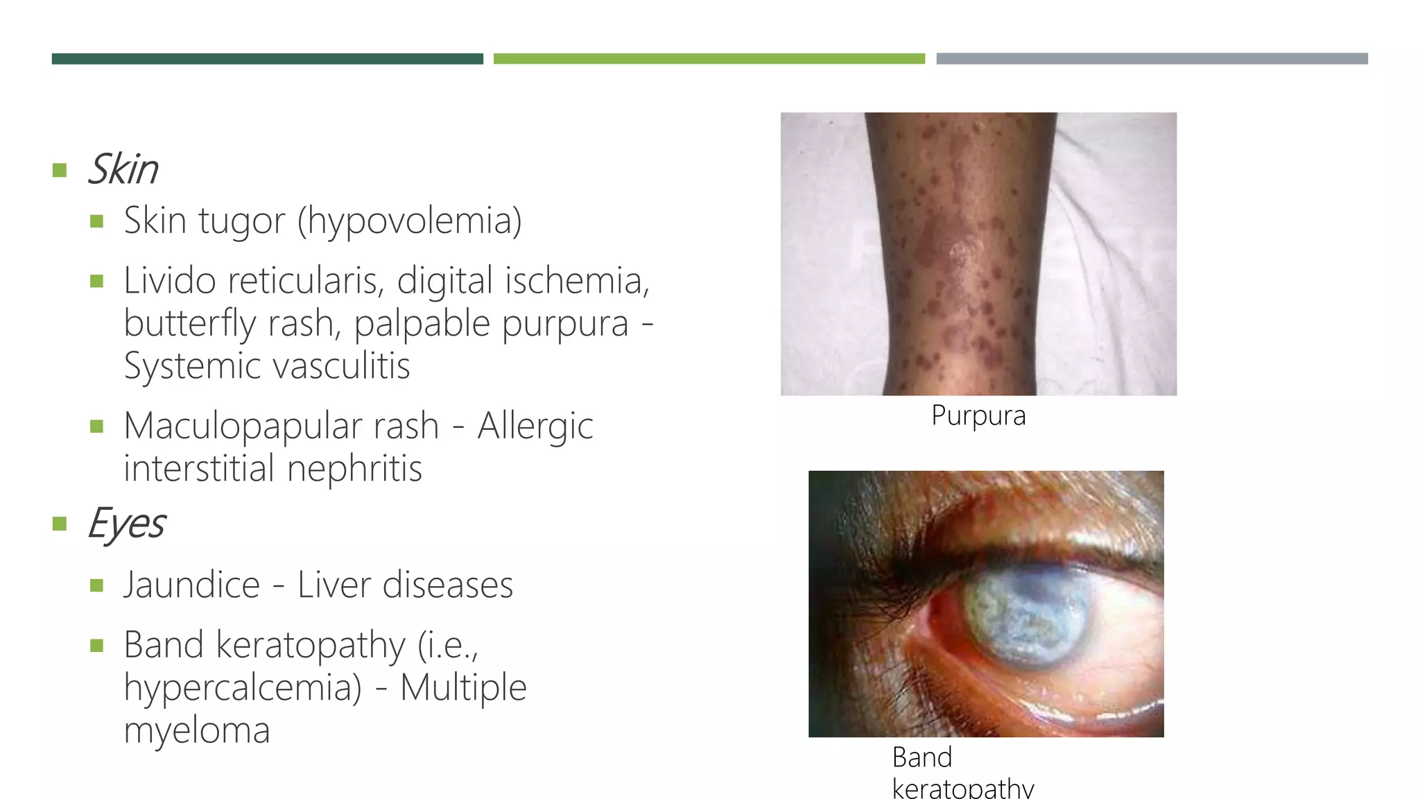 ACUTE KIDNEY INJURY.pptx