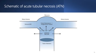 Acute kidney injury.pptx