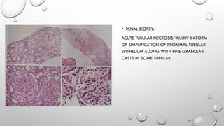 Acute Kidney Injury.pptxkoijhhhhhhhhhhhhh | PPTX