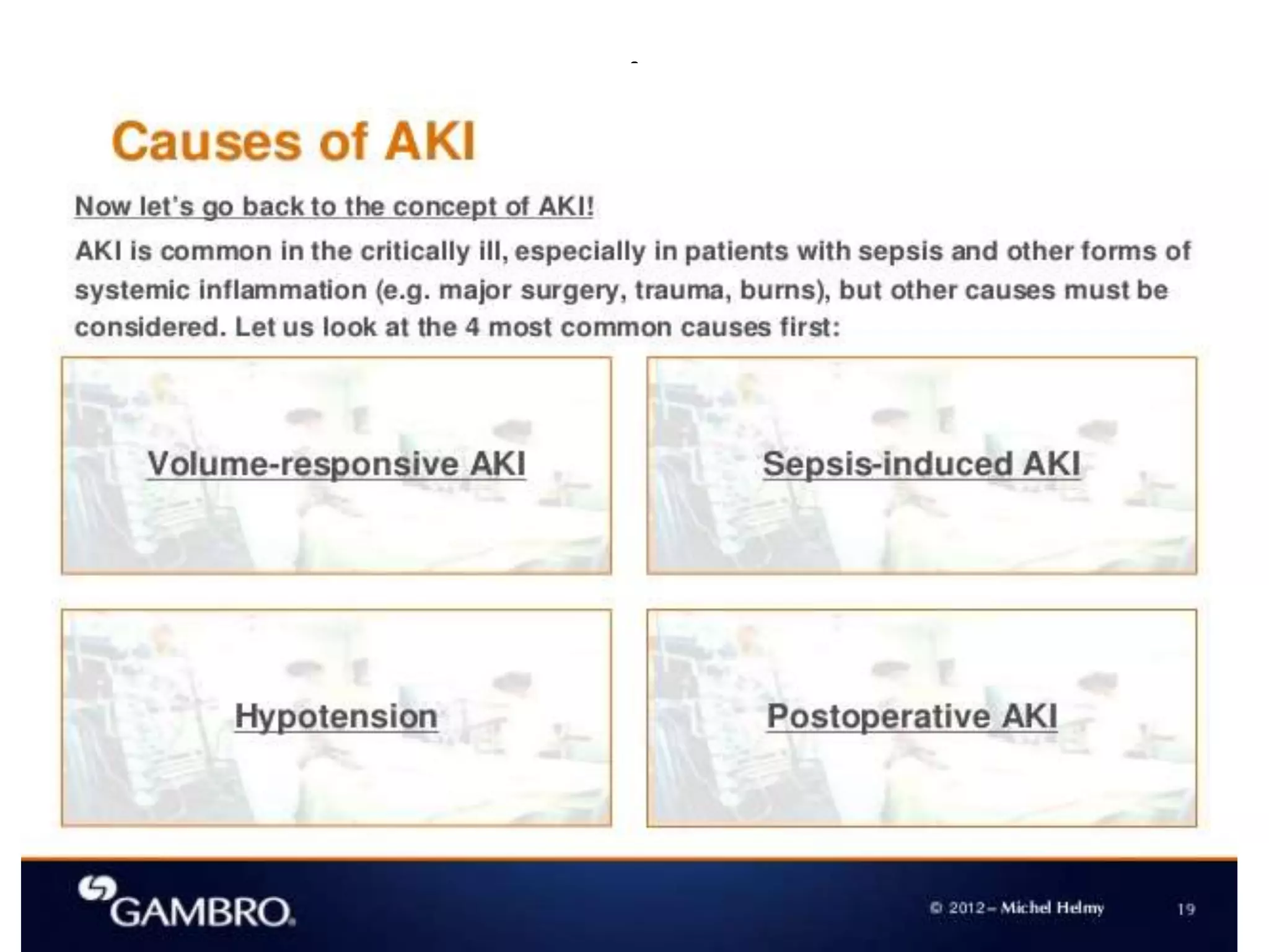 Acute kidney injury,aki 2 | PPTX