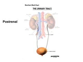 acute kidney injury berdasarkan kdigo 2012 | PPT