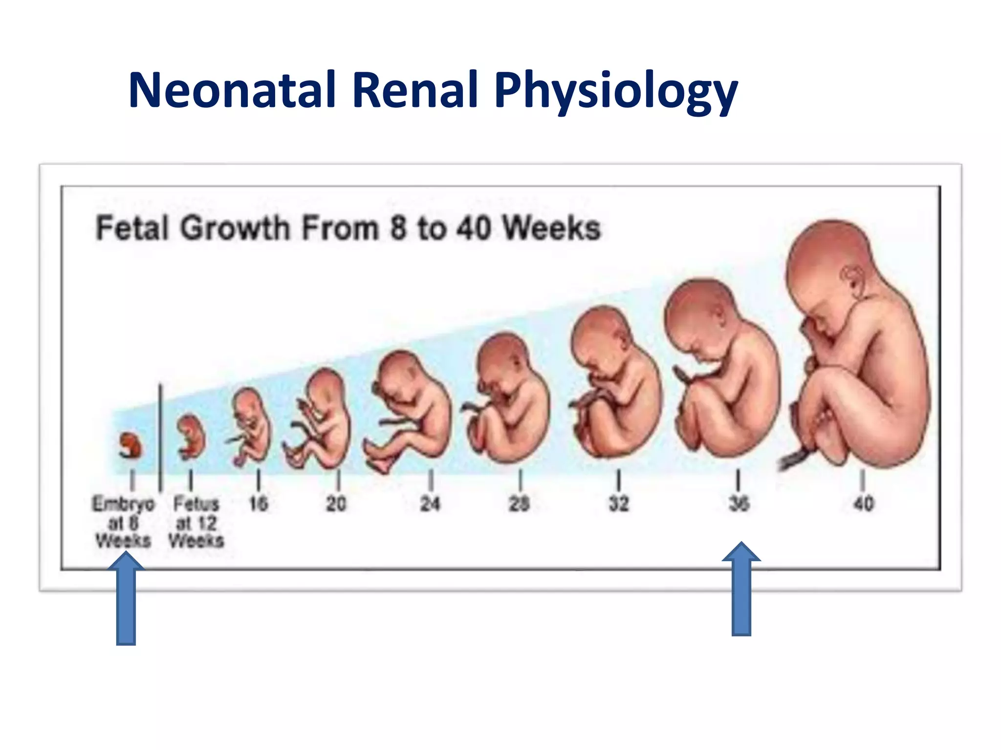 Acute kidney injury in neonate | PPTX