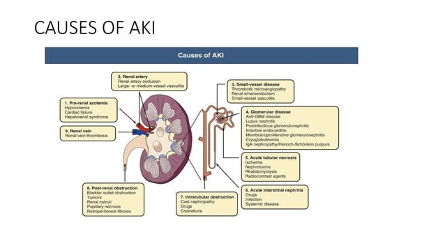 ACUTE KIDNEY INJURY (PATHOPHYSIOLOGY, DIAGNOSIS,.pptx
