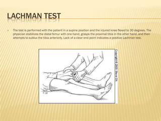 Acute knee injury | PPTX