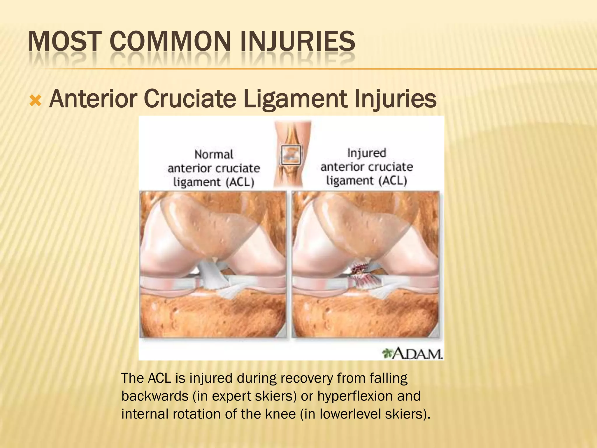 Acute knee injury | PPTX