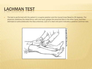 Acute knee injury | PPTX