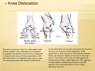 Acute knee injury | PPTX | Death, Injury, or Military Conflict ...