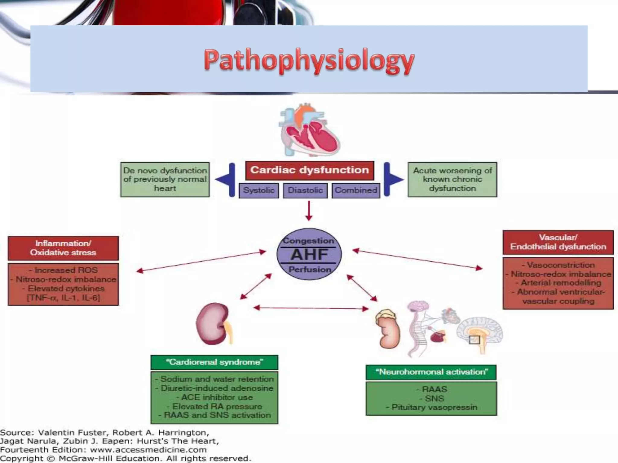 Acute left ventricular failure | PPTX