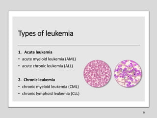 ACUTE LEUKAEMIA.pptx