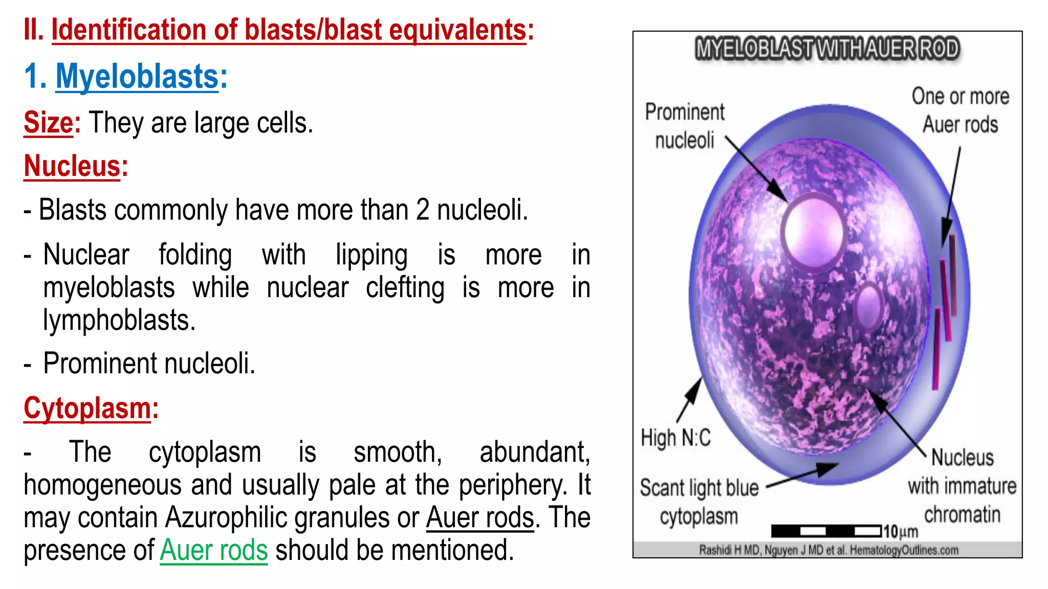 Overview to Diagnosis of Acute leukemia | PDF