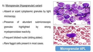 Overview to Diagnosis of Acute leukemia | PDF