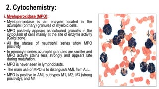 Overview to Diagnosis of Acute leukemia | PDF