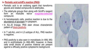 Overview to Diagnosis of Acute leukemia | PDF