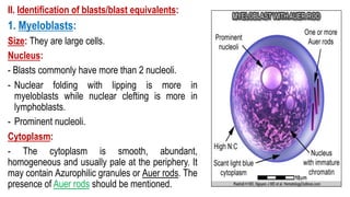 Overview to Diagnosis of Acute leukemia | PDF