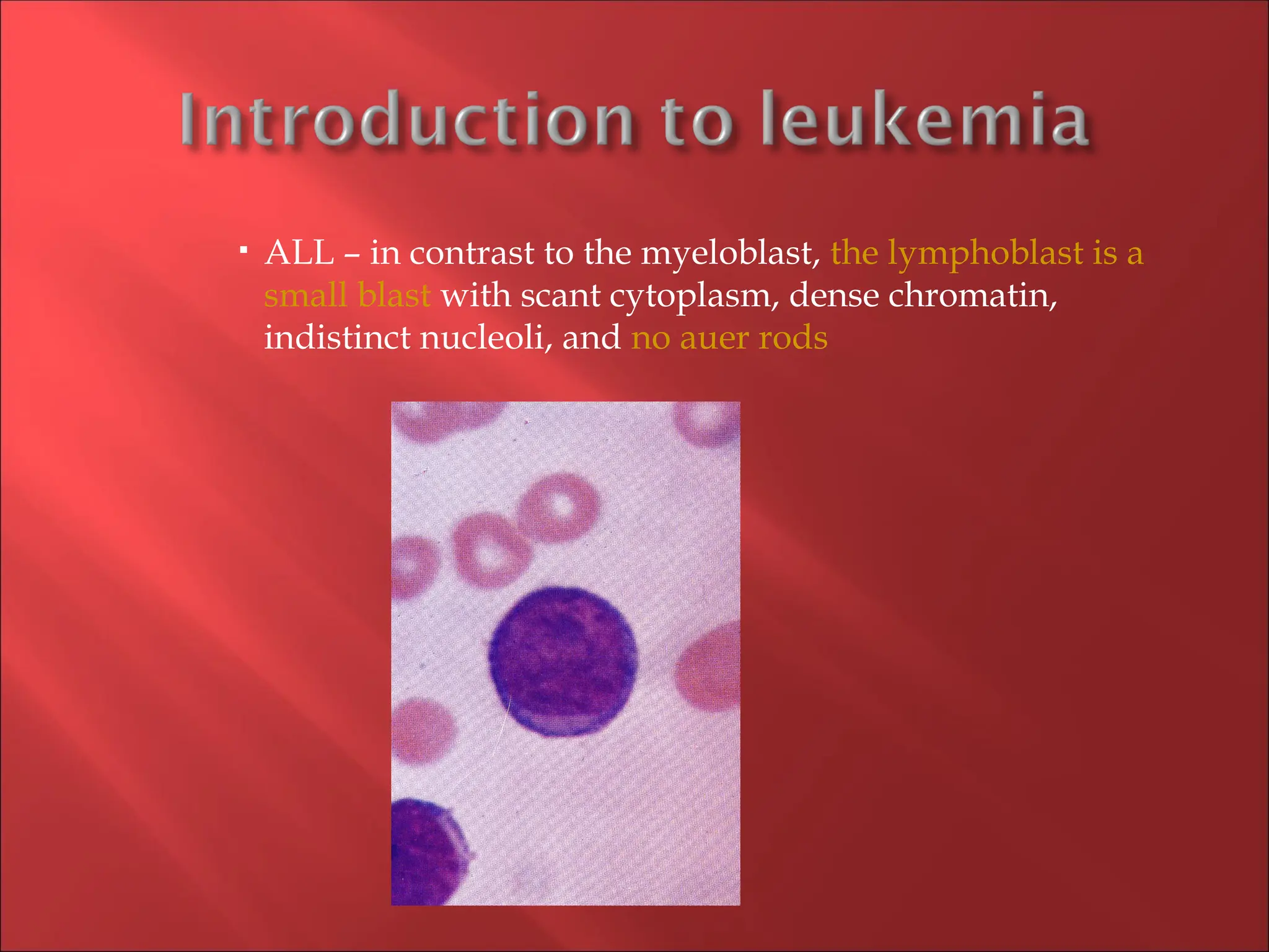 Acute leukemia-acute leukemia Irina.ppt